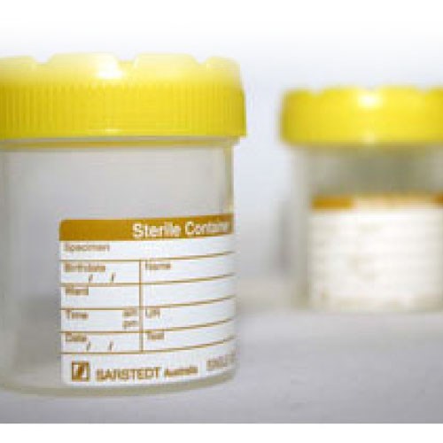 Specimen Container 70ml